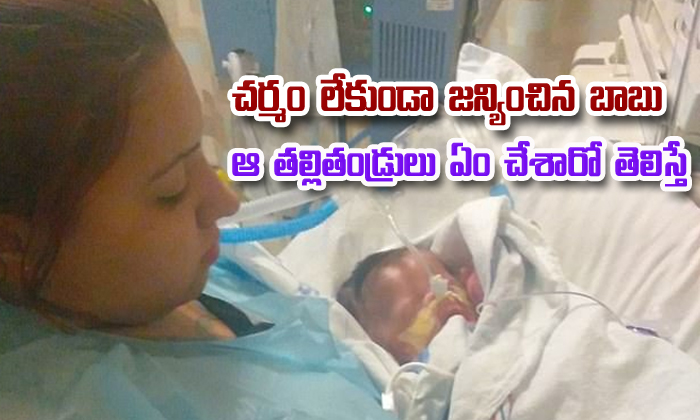 చర్మం లేకుండా జన్మించిన బాబు... ఆ తల్లిదండ్రులు ఏం చేశారో తెలిస్తే ...